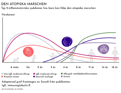 Atopiskt eksem hos barn | Atopiker.se från Sanofi
