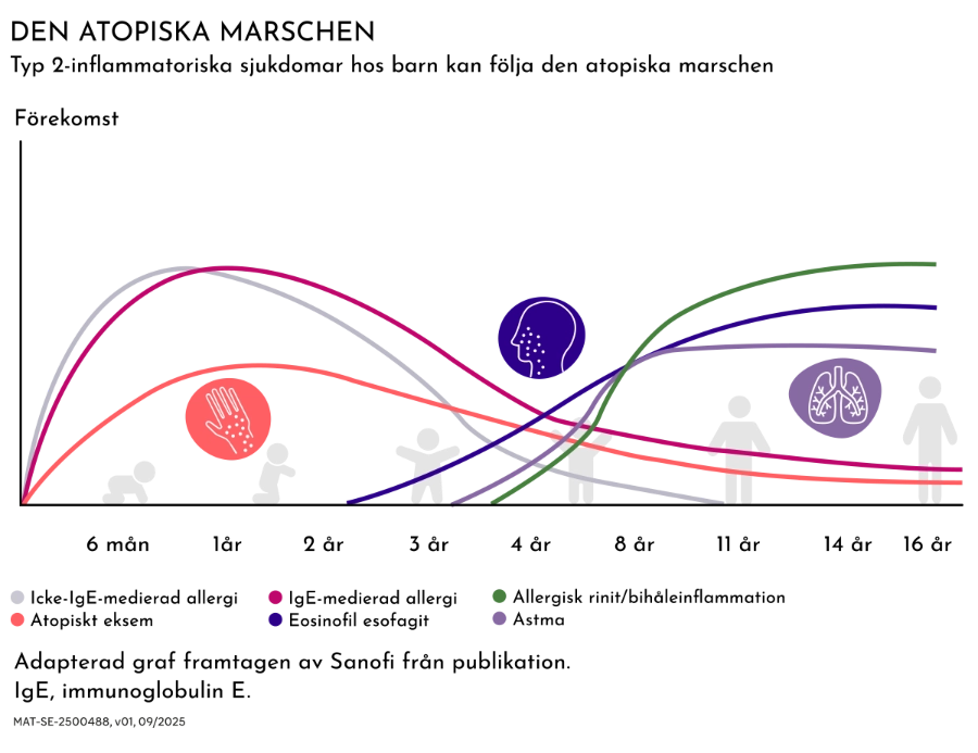 Atopiskt eksem hos barn | Atopiker.se från Sanofi